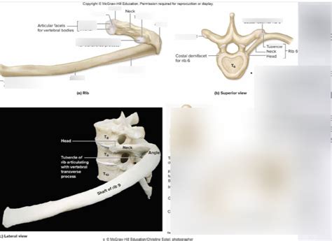 Anatomy L Axial Skeleton Ribs Diagram Quizlet