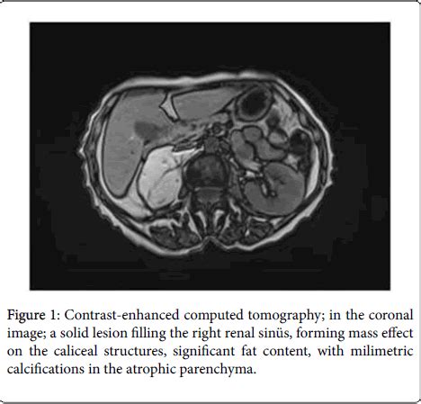 Medical Diagnostic Methods Solid Lesion