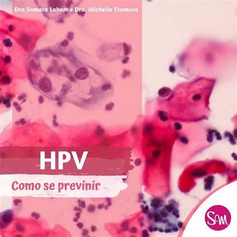 HPV O que você precisa saber