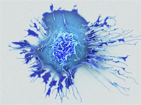 dendritic cell microscope