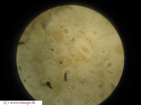Histology Slides Database Compact Bone Histology Slide