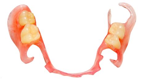 Orofacial Alguns Tipos De Pr Teses Remov Veis Pontes M Veis