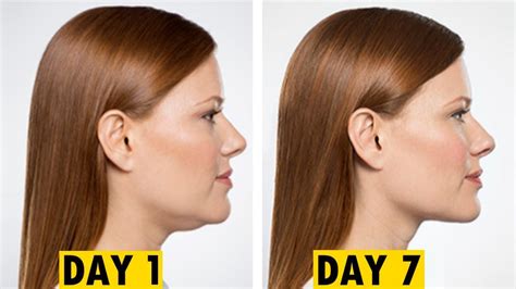 How To Get Rid Of Double Chin At Home Naturally Fast Easy YouTube