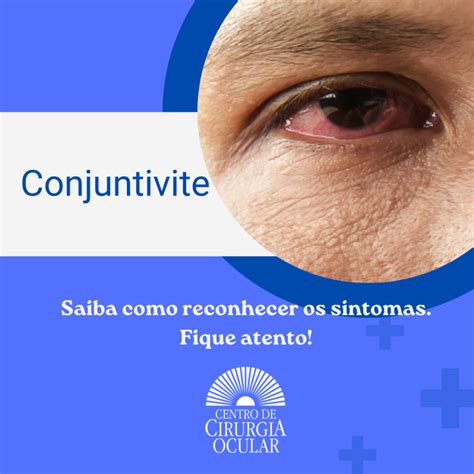 Conjuntivite Uma Visão Detalhada sobre os Tipos Sintomas e