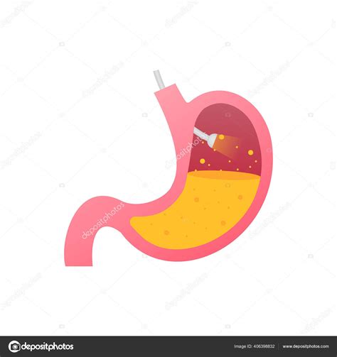 Esophagus And Stomach Cartoon