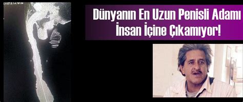 DUNYANIN EN BUYUK YARAKLI ADAMI Telegraph