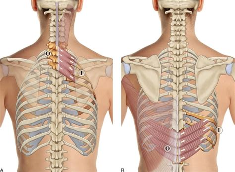 Muscles Of The Spine And Rib Cage Musculoskeletal Key In