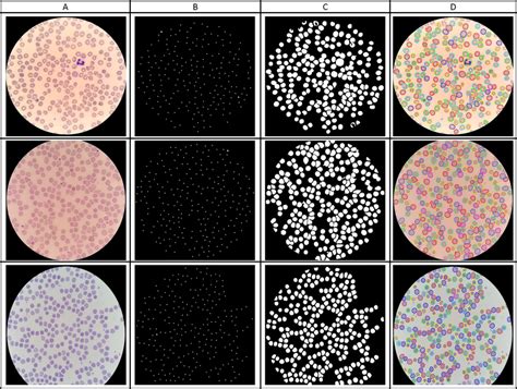 rbc detection and segmentation using level sets a input image b download scientific