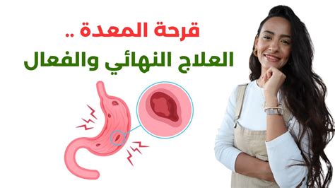علاج قرحة المعدة تعافي الأمعاء بشكل نهائي العلاج من الطبيعة بدون
