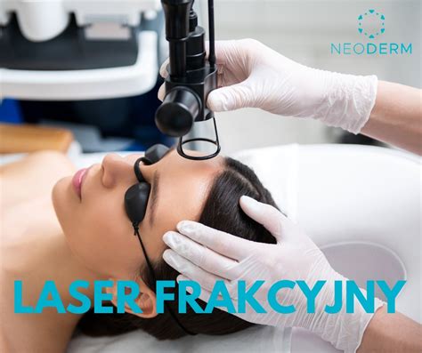 Laser frakcyjny CO2 Klinika Neoderm Siedlce oraz Mińsk Mazowiecki
