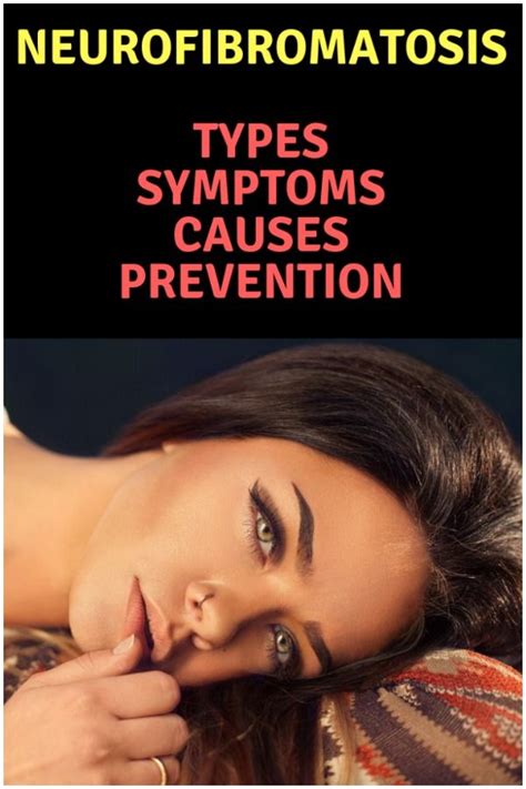 Neurofibromatosis Types Symptoms Causes Prevention Life