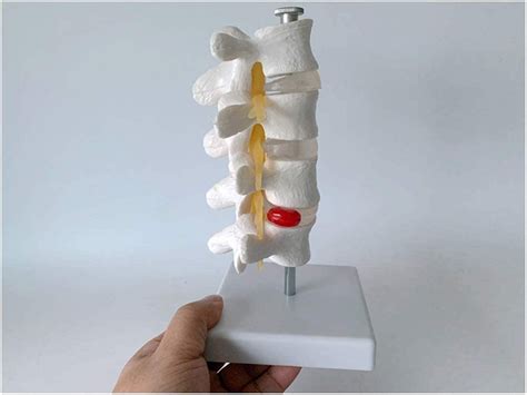 Buy Anatomy Model Lumbar Model Educational Model Human Body Anatomy