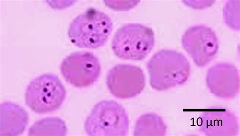Plasmodium Falciparum Rings Parasitology