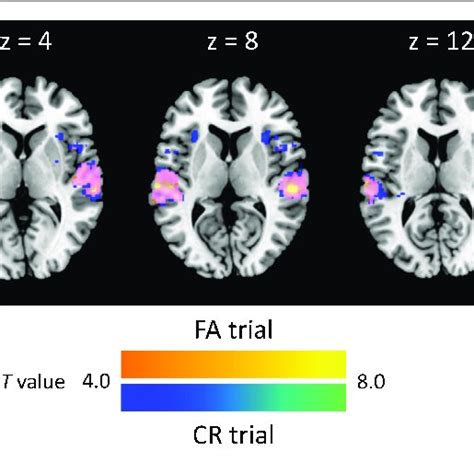 extent and intensity of auditory related activations activated areas download scientific