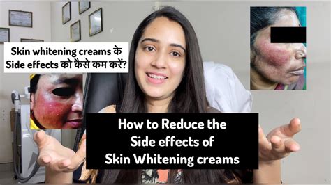 Skin Whitening Creams Side Effects How To Reduce Side Effects