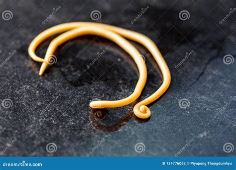 Ascariasis Is A Disease Caused By The Parasitic Roundworm Ascaris