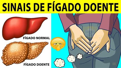 Sinais De F Gado Doente Youtube