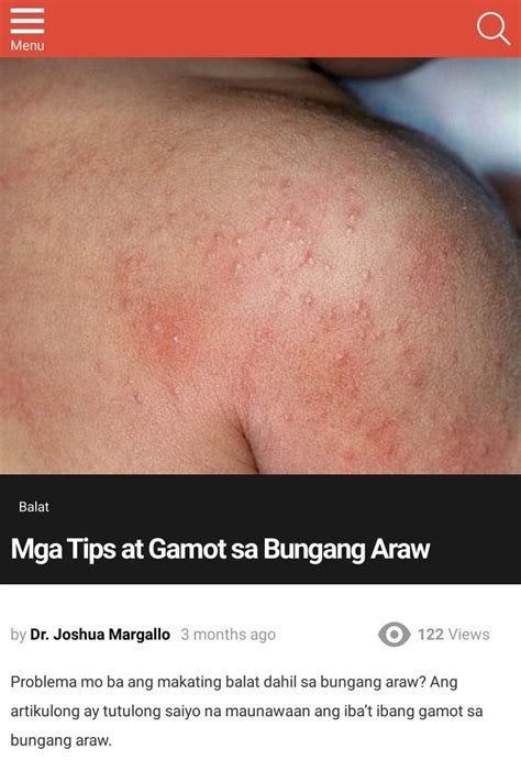 Problema Mo Ba Ang Makating Balat Dahil Sa Bungang Araw Ang Artikulong