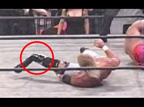 10 Exceptionally Devastating Injuries In Wrestling YouTube