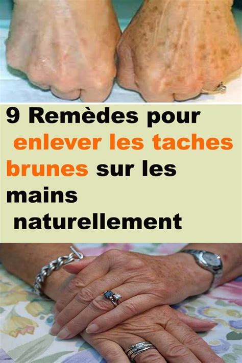9 Remèdes pour enlever les taches brunes sur les mains naturellement
