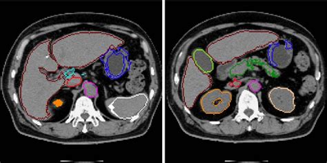 [pdf] segmentation of multiple organs in non contrast 3d abdominal ct images semantic scholar