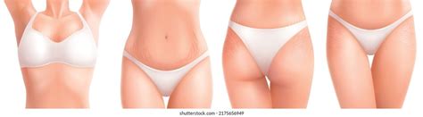 Stretch Marks Icon Images Stock Photos Vectors Shutterstock