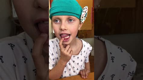 Loose Teeth Youtube