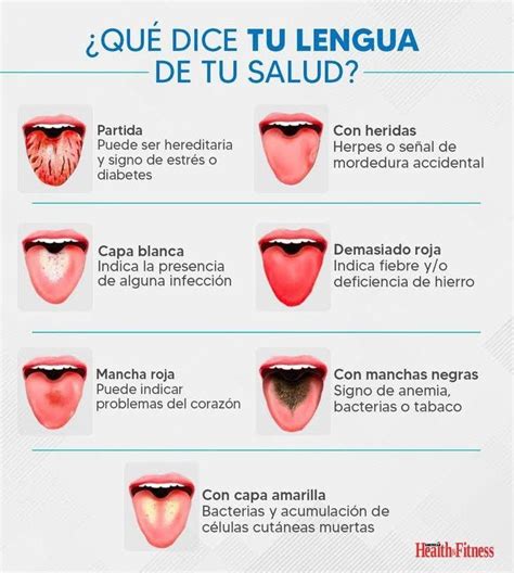 El Color De Tu Lengua Revela Tu Estado De Salud En Total Son Colores
