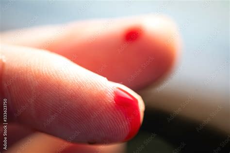 Finger Cut Bleeding Injured With Knife Flesh Blood Wound In Hand