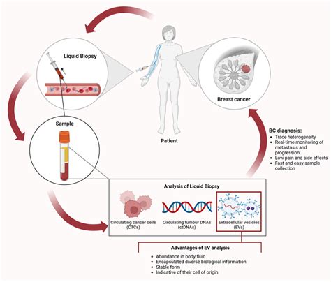 Liquid Biopsy For Breast Cancer BC Diagnosis Body Fluids Are