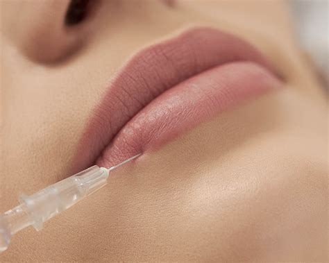 Ácido hialurónico labios ojeras yotros rellenos faciales Dra María