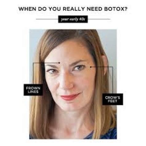 Clínica de Aplicação de Botox Cotanet