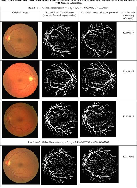 figure 1 from retinal image segmentation by using texture based gabor filter optimized by