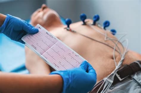 Electrocardiograma Qu Es Y C Mo Se Mide Genea