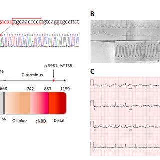 A Upper Half Sequencing Result Reverse Sequence Chromatogram