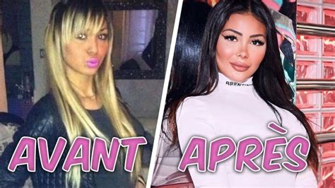 Maeva Ghennam Les chirurgies esthétiques qu elle a subies