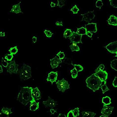 What Blood Platelets And Endothelial Cells May Reveal About COVID 19