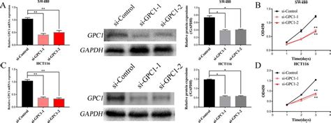 Silencing GPC1 Inhibits CRC Cell Proliferation A C CRC Cell Lines