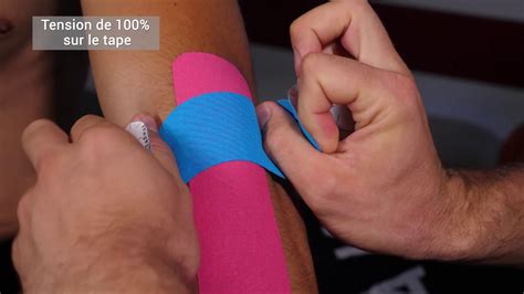 Tape Kinésiologie Tennis Elbow Epicondylite YouTube