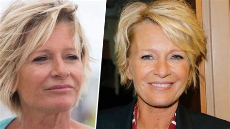 Sophie Davant assume avoir eu recours à la chirurgie esthétique