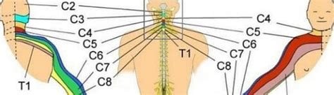 Cervical Radiculopathy Feature Rebalance Sports Medicine