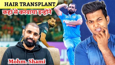 Mohammad Shami न HAIR TRANSPLANT कह स करवय ह Cricketer Hair