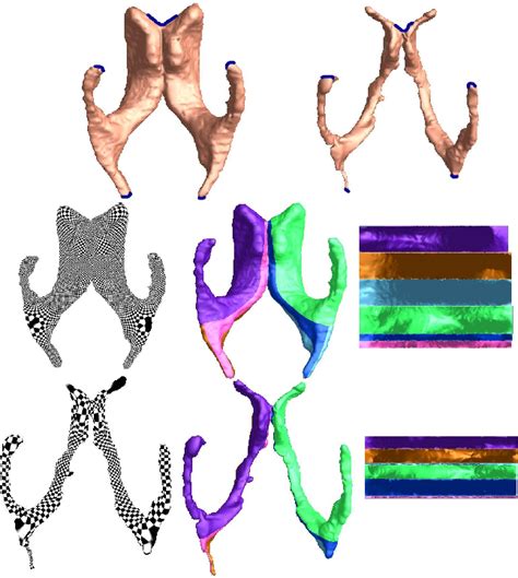 figure 1 from brain surface conformal parameterization semantic scholar