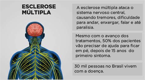 O que é a Esclerose Múltipla Thyninha