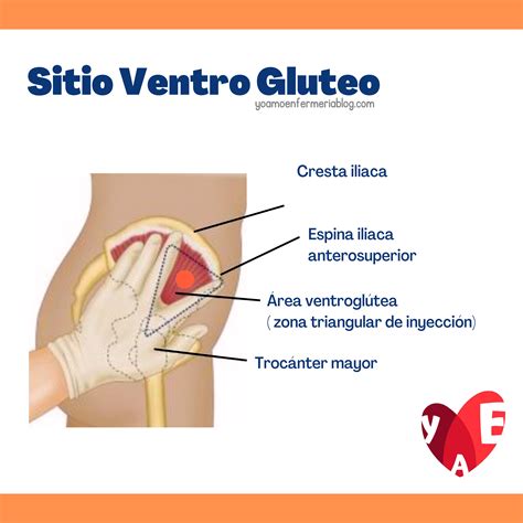 Inyecciones material anatomía y sitios de aplicación