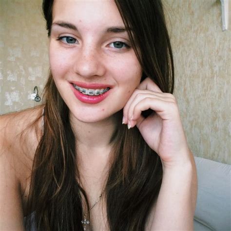 Braces Tumblr Girls Giving Head