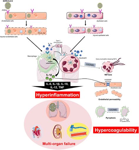 Interleukin 1 And The NLRP3 Inflammasome In COVID 19 Pathogenetic And