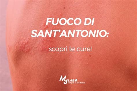 Fuoco Di Sant Antonio Scopri Le Cure