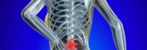 Réduire les maladies musculo squelettiques comment faire