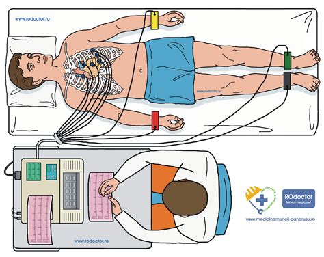 Como Colocar Los Electrodos Del Electrocardiograma Ecg Youtube NBKomputer